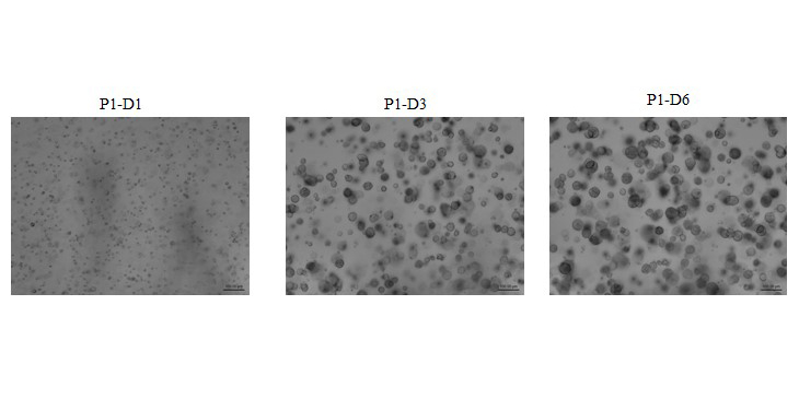 Human Esophageal Cancer Organoid Kit | MedChemExpress