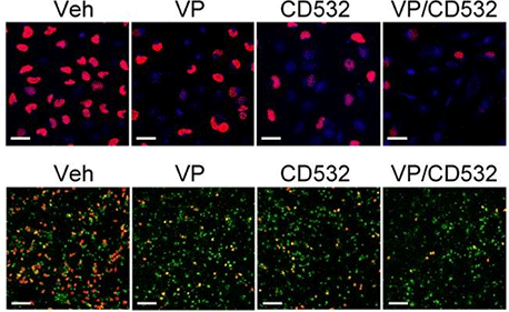 Verteporfin (CL 318952) | YAP Inhibitor | MedChemExpress