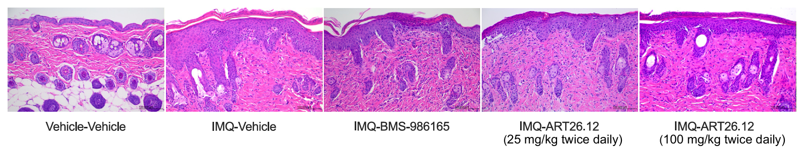 Deucravacitinib (BMS-986165) | TYK2 Inhibitor | MedChemExpress
