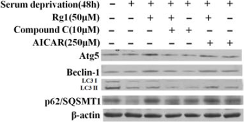 Dorsomorphin (Compound C) | AMPK Inhibitor | MedChemExpress