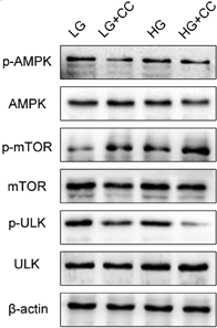 Dorsomorphin (Compound C) | AMPK Inhibitor | MedChemExpress