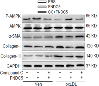 Dorsomorphin (Compound C) | AMPK Inhibitor | MedChemExpress