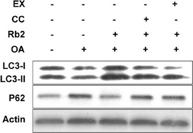 Dorsomorphin (Compound C) | AMPK Inhibitor | MedChemExpress