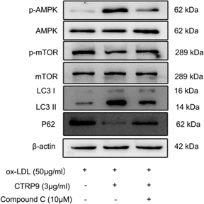 Dorsomorphin (Compound C) | AMPK Inhibitor | MedChemExpress