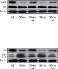 Dorsomorphin (Compound C) | AMPK Inhibitor | MedChemExpress