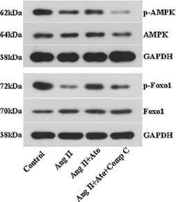 Dorsomorphin (Compound C) | AMPK Inhibitor | MedChemExpress