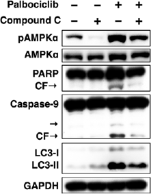 Dorsomorphin (Compound C) | AMPK Inhibitor | MedChemExpress