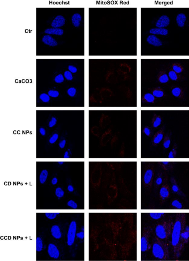 MitoSOX Red | Mitochondrial ROS Indicator | MedChemExpress