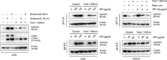 Torin 1 | mTOR Inhibitor | MedChemExpress