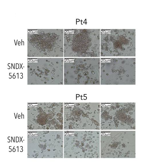 Revumenib (SNDX-5613) | Menin-MLL Inhibitor | MedChemExpress