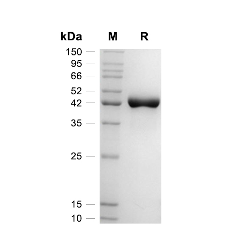LRPAP1 Protein, Mouse (HEK293, His) | MedChemExpress
