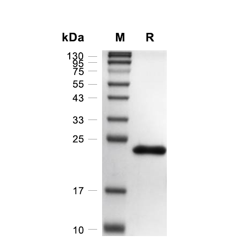 Adenylate Kinase 1/AK1 Protein, Rat (His) | MedChemExpress