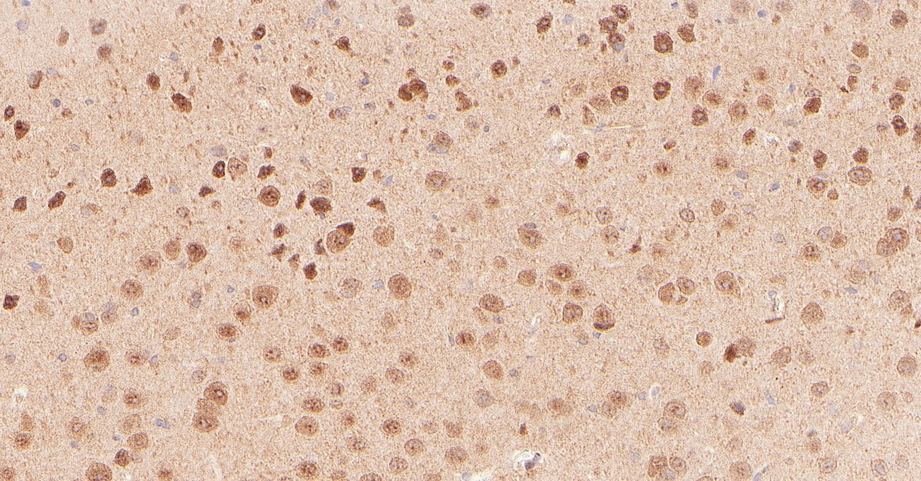 RUNX2 Antibody (YA085) | MedChemExpress