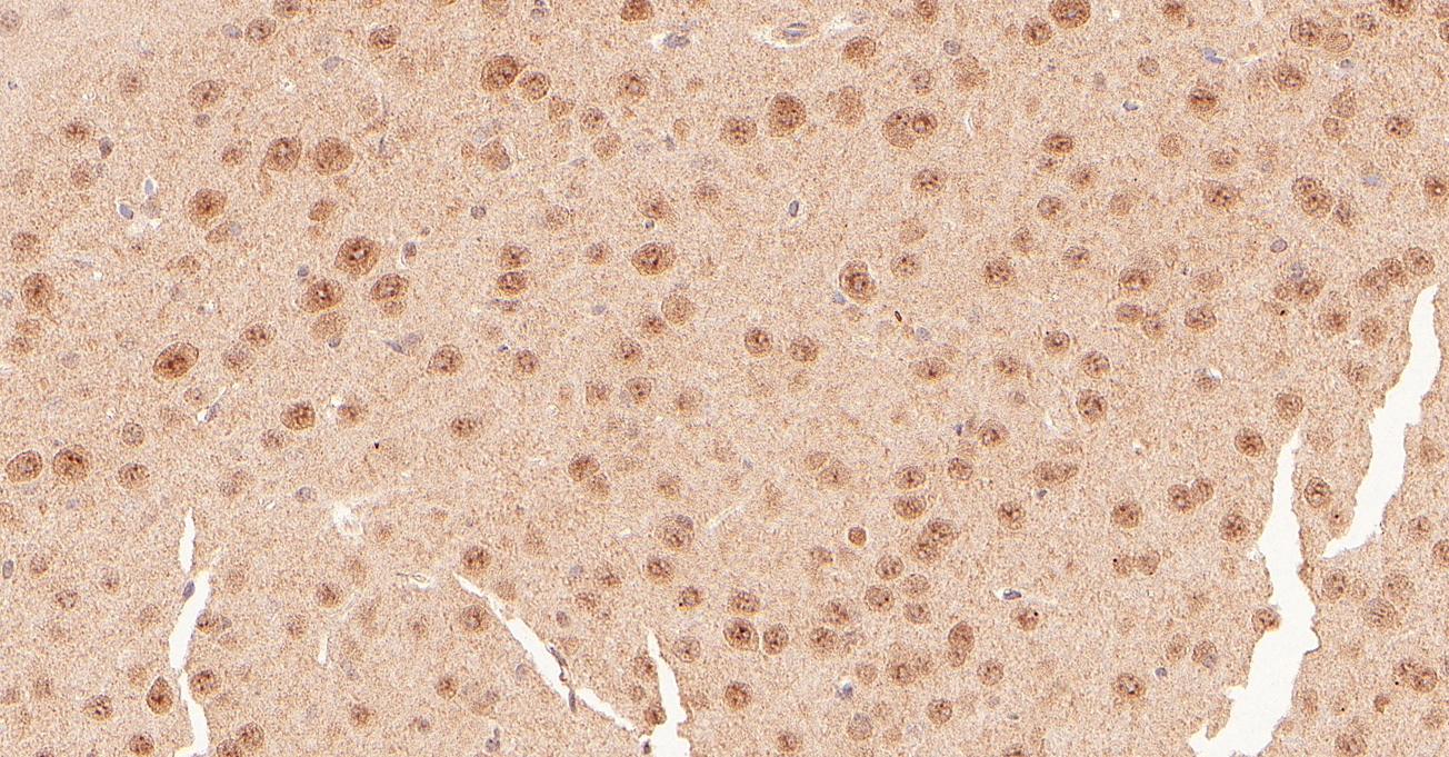 RUNX2 Antibody (YA085) | MedChemExpress