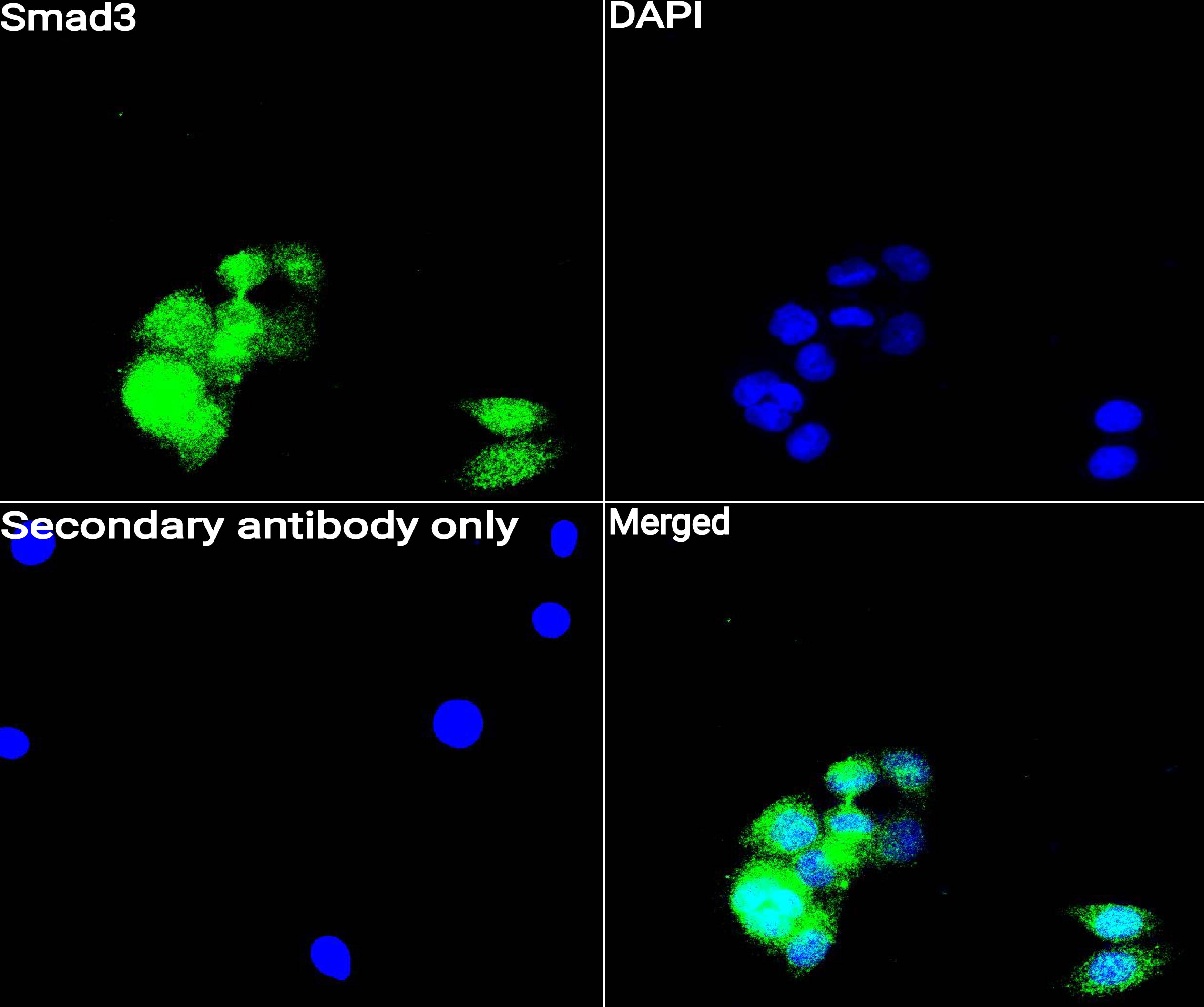 Smad3 Antibody (YA075) | MedChemExpress